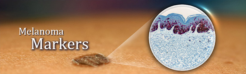 Melanoma Markers Genetex